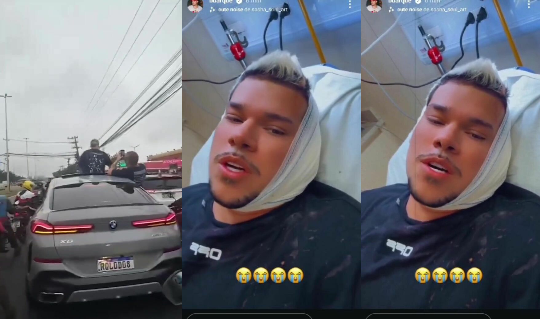 Man Suffers Rocket Accident That Tears Off Piece Of His Ear