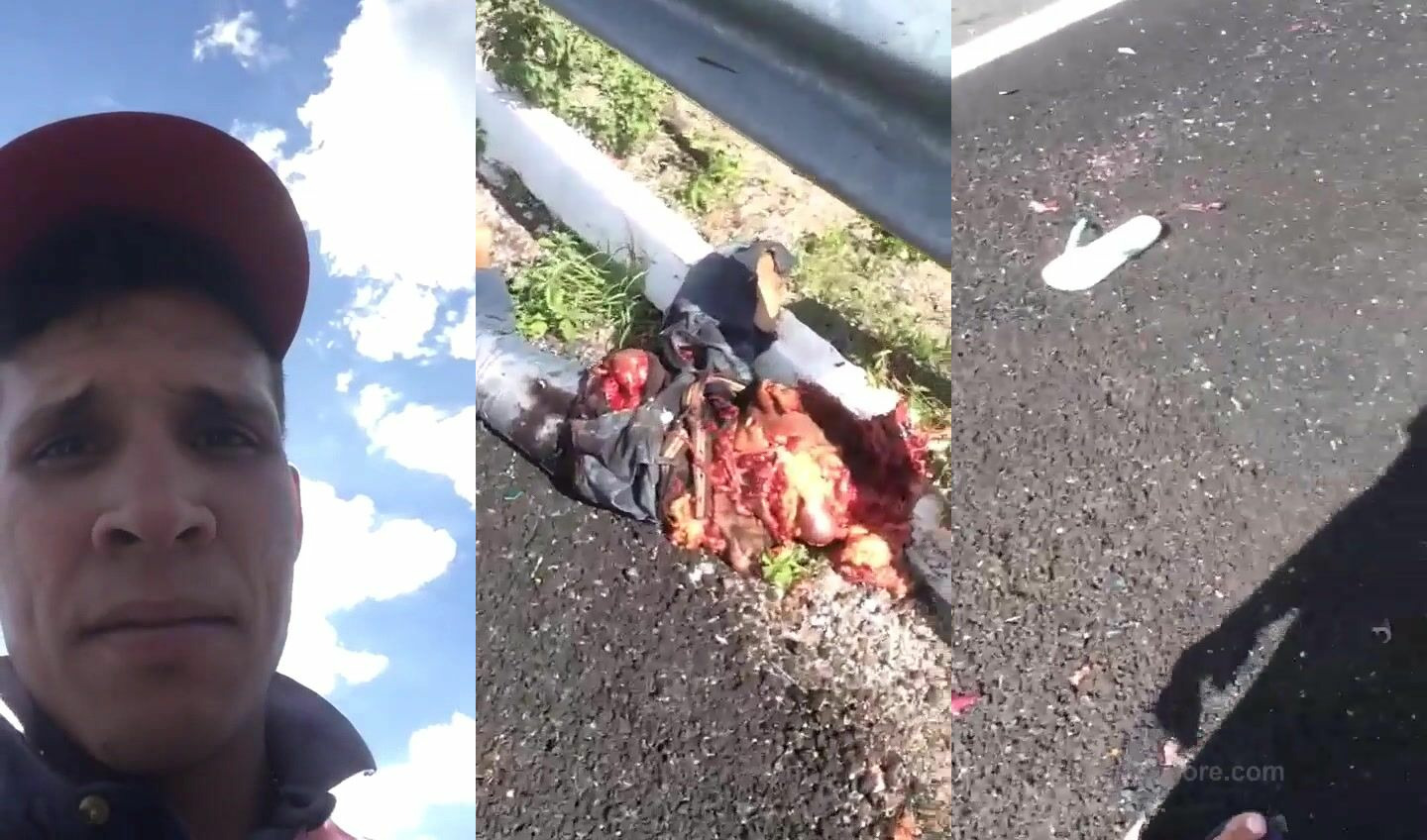 Due To The Accident, Only The Legs Are Left